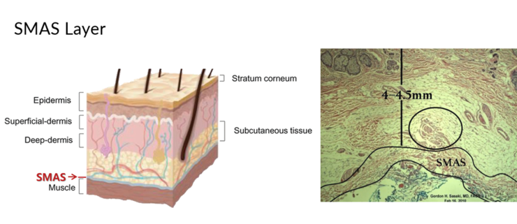 SMAS : 네이버 블로그