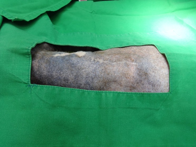 부신피질 기능저하증 에디슨 갑상선기능저하증 석회종 제거술 쵸코 네이버 블로그