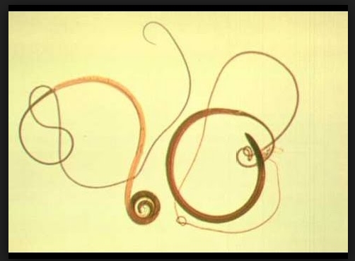 편충, Trichuris trichiura, whipworm(Trichuriasis) : 네이버 블로그