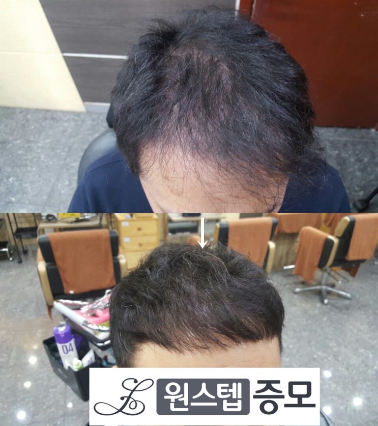 이마 넓은 남자 머리 어울리는 헤어스타일 찾기 네이버 블로그
