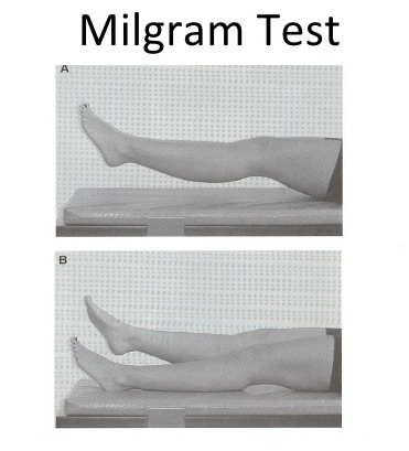 Milgram test : 수막근처의 병변을 조사하는 테스트 : 네이버 블로그
