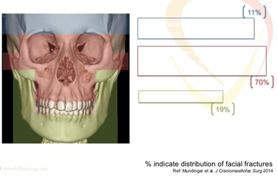 안면 골절(Facial bone fractures) : 네이버 블로그