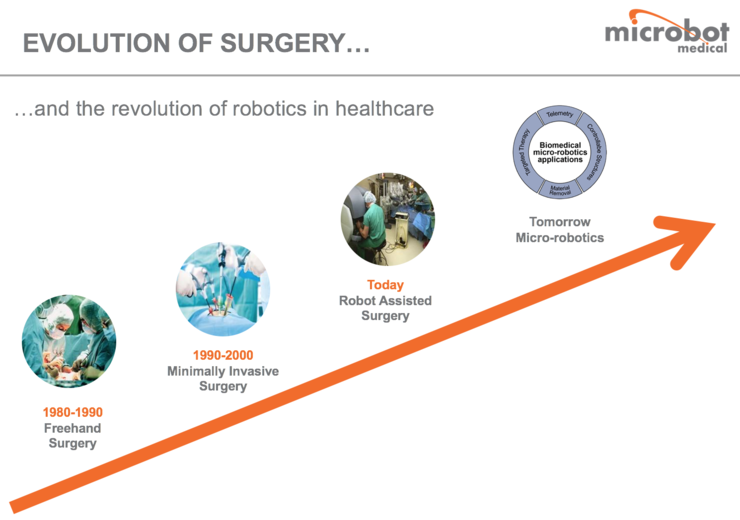 [영상] Microbot Medical 의 미래형 수술 로봇 ViRob : 네이버 블로그
