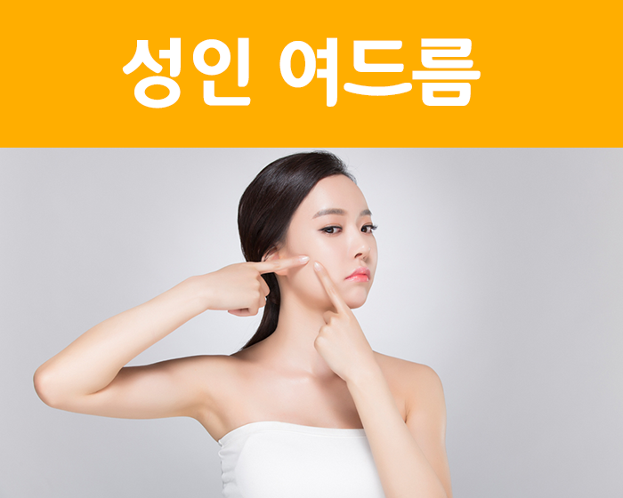 성인 여드름 관리 하는방법 알아봐요 네이버 블로그