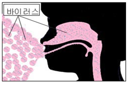 감기(보통 감기) Cold(Common cold/Acute nasopharyngitis/Upper respiratory ...