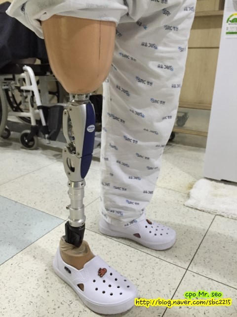 3R60과 3R60 PRO 유압식 대퇴의족 착용 및 보행연습/3R60서울의족가격문의/서병철의족/에스앤피(S&P)의족케어센터 ...