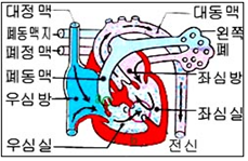 팔로 4징과 팔로 3징 Tetralogy of Fallot and Trilogy of Fallot : 네이버 블로그
