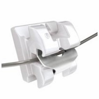 [정관 교정치과] Clippy-C 교정장치 : 네이버 블로그