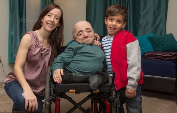 당신의 삶은 선물입니다! - 숀 스티븐슨(Sean Stephenson) 이야기 : 네이버 블로그