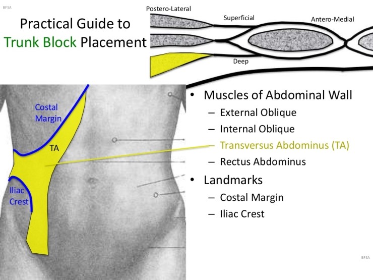 Transversus Abdominis plane block [초음파] : 네이버 블로그