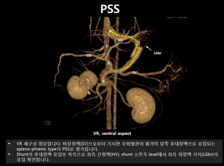 개 강아지 PSS 증상 검사 진단 CT촬영 수술 양천구 영등포구 구로구 동물병원 : 네이버 블로그