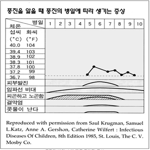 풍진(3일 홍역) Rubella(German measles/three-day measles) : 네이버 블로그