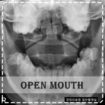 Open Mouth : 네이버 블로그