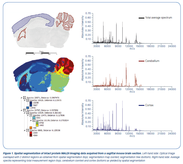 [Bruker MALDI TOF/TOF] rapifleX - Intact 단백질과 on-tissue digestion 후의 쥐 ...
