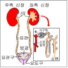 이중 요관 Double ureters : 네이버 블로그