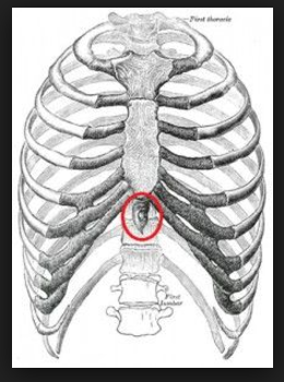 Xiphoidalgia : 네이버 블로그