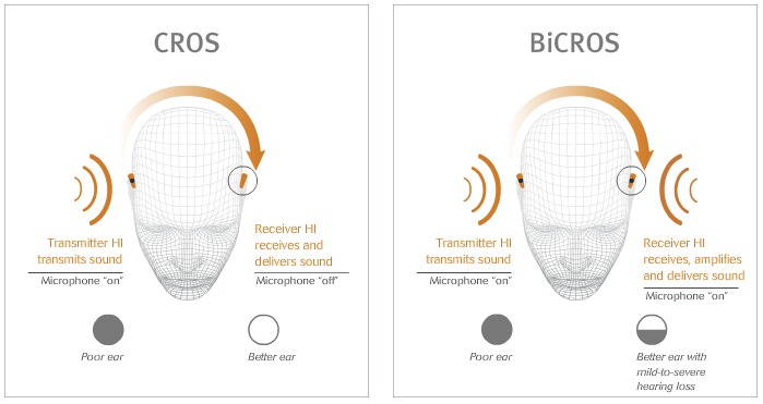 외부크로스 보청기(External CROS hearing aid)의 종류 : 네이버 블로그