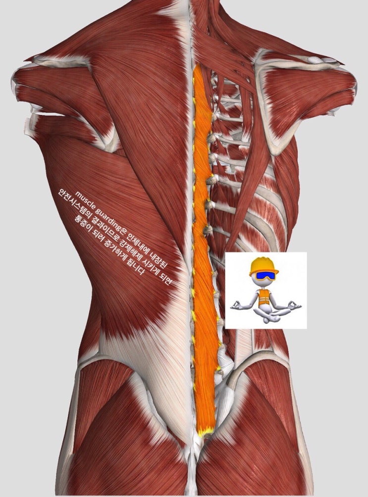 Muscle Guarding과 Muscle Stiffness는 이제는 구분하자 : 네이버 블로그