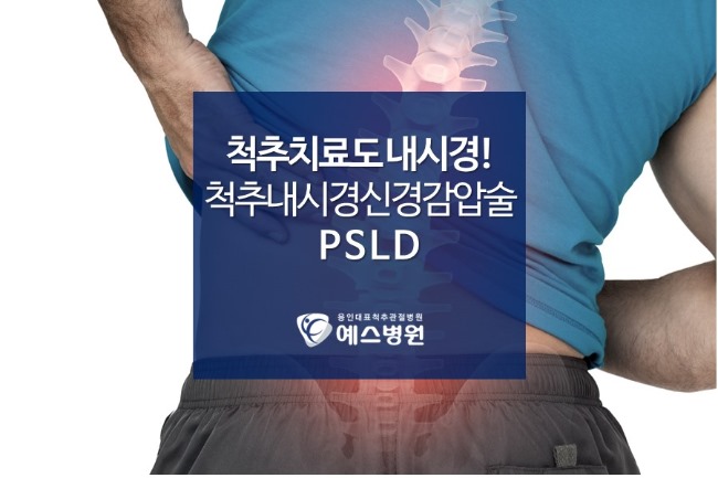 PSLD! 척추치료도 내시경으로! 척추내시경신경감압술 : 네이버 블로그