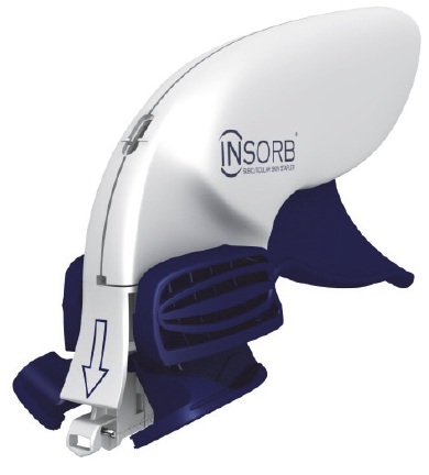 인소브[INSORB] "더 빠르고, 더 나은 방법의 봉합은?" : 네이버 블로그