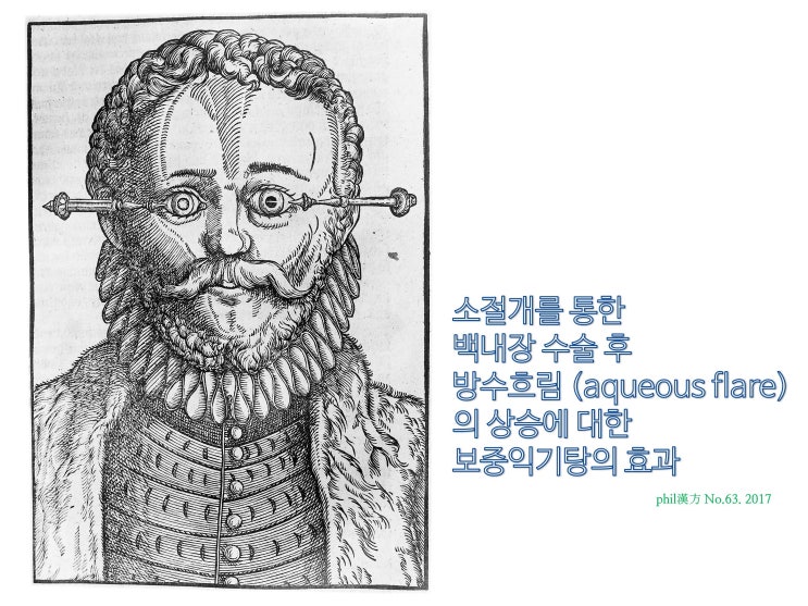 소절개를 통한 백내장 수술 후 방수흐림 (aqueous flare)의 상승에 대한 보중익기탕의 효과 : 네이버 블로그