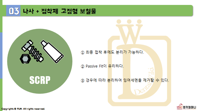 [임플란트] 유지 방식에 따른 보철의 분류(SCRP) : 네이버 블로그