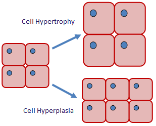 과연 성인의 지방세포의 수는 변하지 않는가? : 지방세포의 비대(Hypertrophy)와 증식(Hyperplasia ...