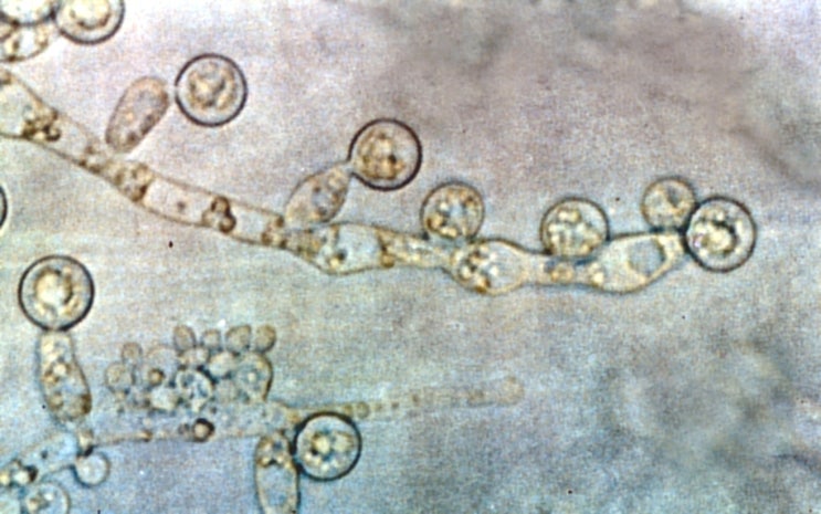 캔디다를 잡자!) Zand, Candida Quick Cleanse : 네이버 블로그