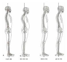 FOUR TYPES OF POSTURAL ALIGNMENT ( 1. IDEAL PLUMB ALIGNENT) : 네이버 블로그