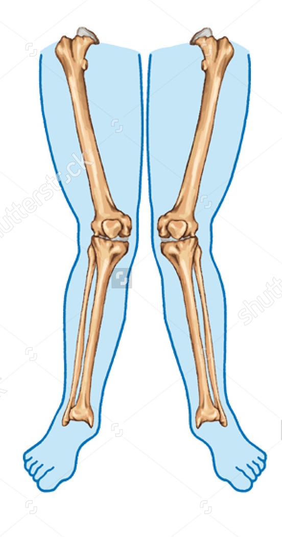 Q Angle Genu Valgum Anatomy of Anterior thigh