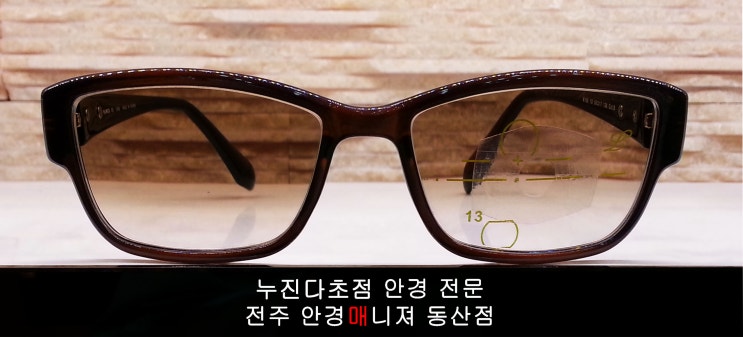 전주】 오른 눈 각막 혼탁 80대 남성 착색 누진다초점 안경으로 선명한 시야 심리적 만족감 모두 해결 네이버 블로그