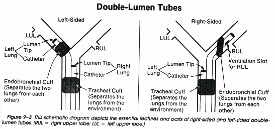Thoracic anesthesia 및 one lung ventilation (일측폐 환기) (3) _ Double-Lumen ...