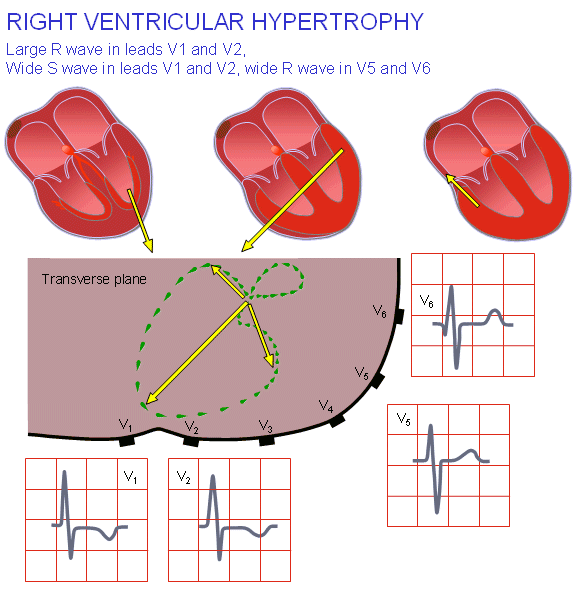 심전도 개요, EKG 파형의 구성, P wave, QRS complex, T wave, U wave, ST segments ...