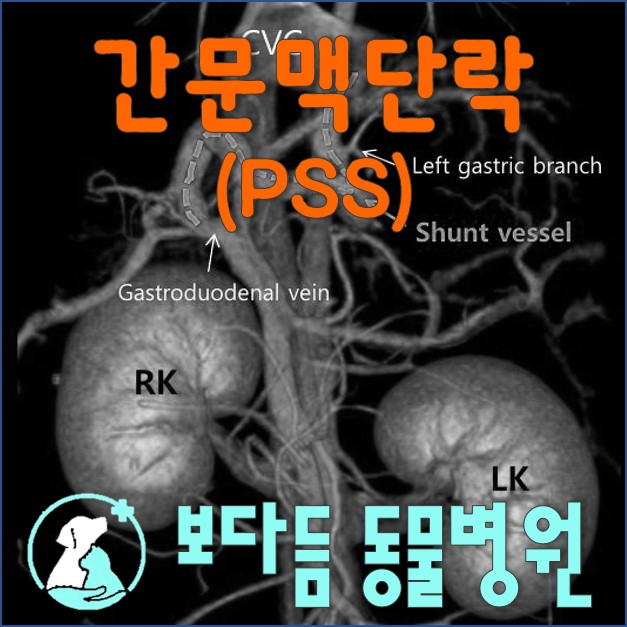 강아지 간문맥단락, 전신문맥단락 (PSS : Portosystemic shunt) 교정술 / Ameroid ring 장착 ...