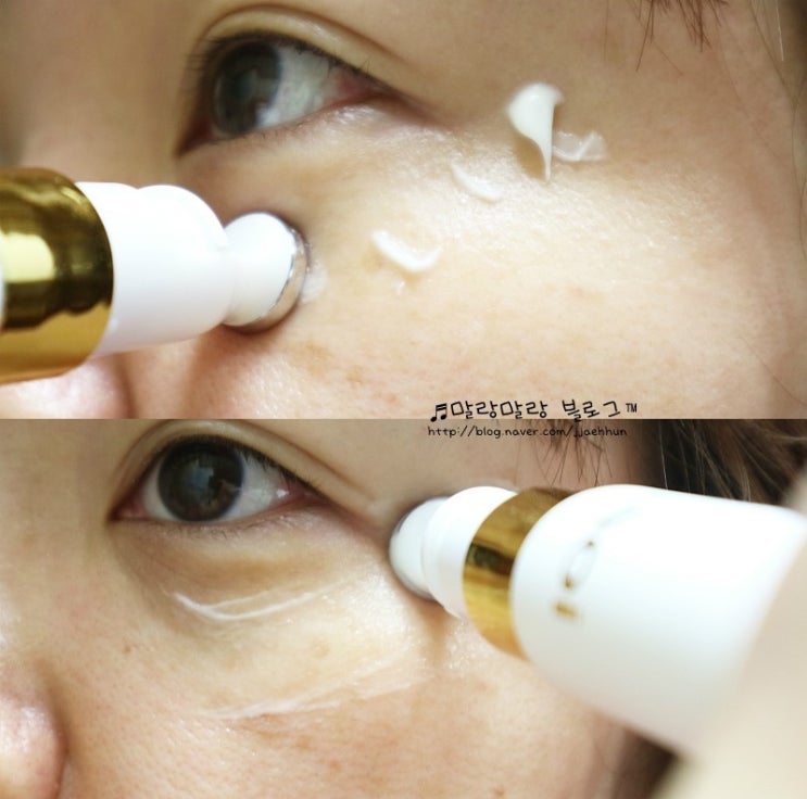 팔자주름관리 아이소이 탄력스팟으로 해요 네이버 블로그
