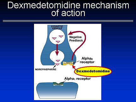 진정과 마취영역에서 dexmedetomidine의 다양한 임상적 적용 : 네이버 블로그