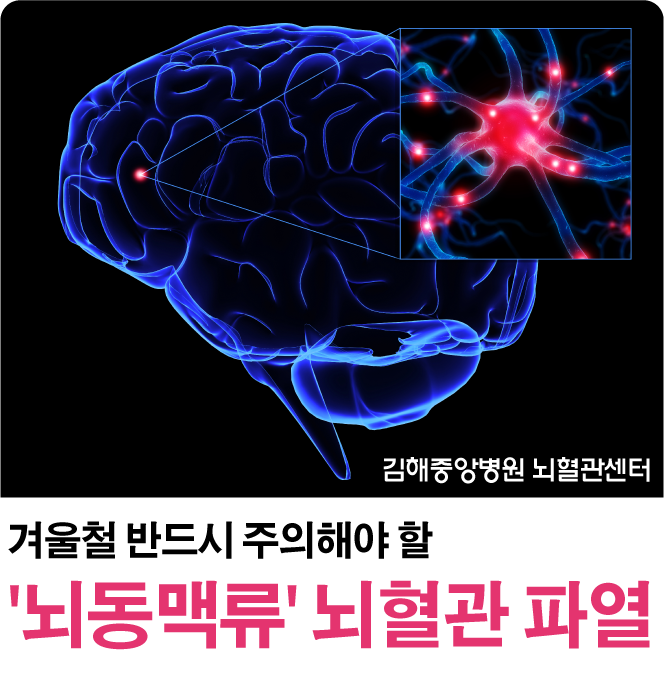 겨울철 반드시 주의해야 할 뇌동맥류 뇌혈관 파열로 이어질 수 있다 네이버 블로그