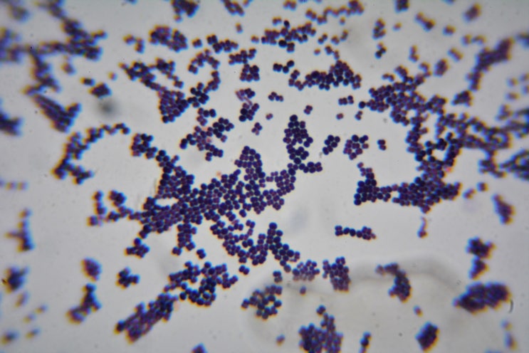 Human Skin Flora - Staphylococcus sp. : 네이버 블로그