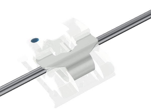 울산 바른이치과교정과치과의원에 클리피씨(Clippy-C)를 도입했습니다 :) : 네이버 블로그