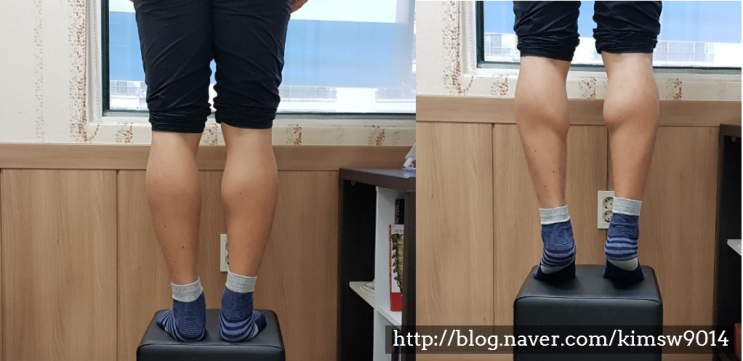 운동하다 갑자기 종아리가 아파요 비복근파열 테니스레그 1 네이버 블로그