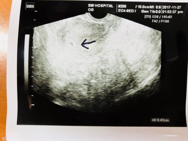 #[두번째 이야기] : 네이버 블로그