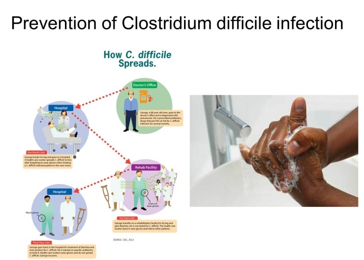 열정♡임상: 클로스트리디움 디피실 감염(Clostridium difficile Infection, CDI) / CDTA ...
