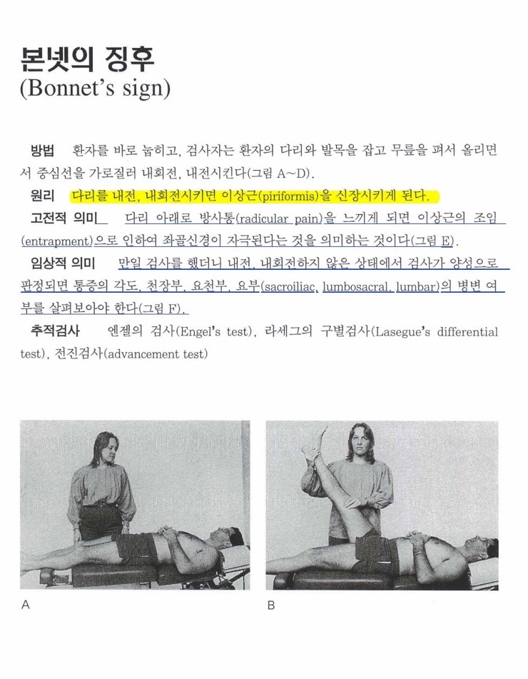 Bonnet`s sign : 네이버 블로그
