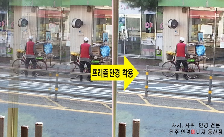 전주】 뇌종양 6번 신경 마비 내사시 심한 복시 교정 프리즘 안경 네이버 블로그