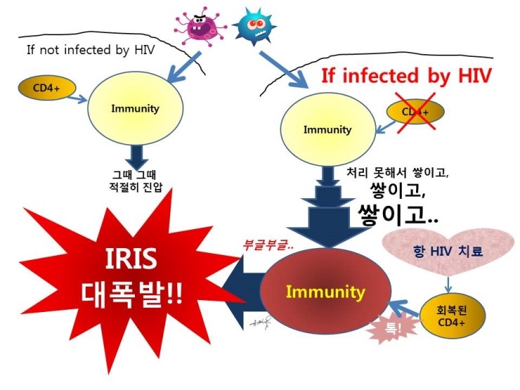에이즈 (HIV/AIDS) =23= IRIS : 숙주의 반격과 과도한 한풀이 : 네이버 블로그