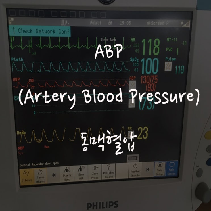 Arterial line monitoring, A-line(ABP, 동맥내혈압)에 대해서. : 네이버 블로그