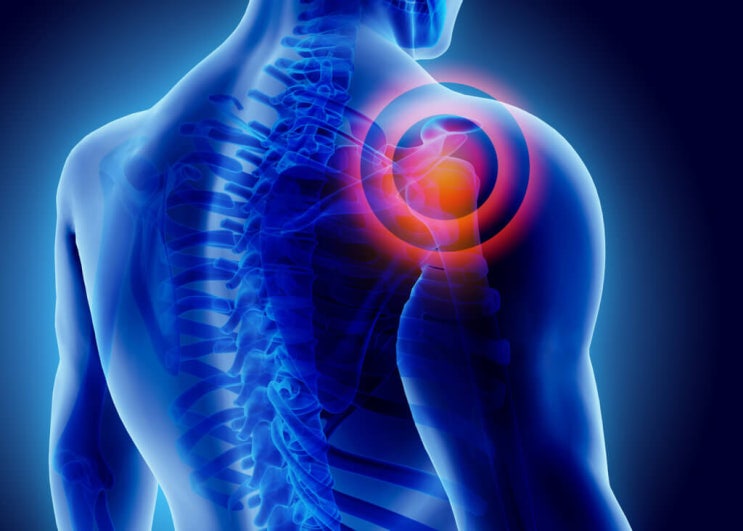 Thaw Frozen Shoulder with Chiropractic Adjustments : 네이버 블로그