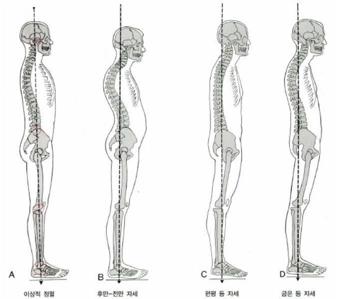 켄달의 자세정렬 너의 자세는 어떻니? : 네이버 블로그