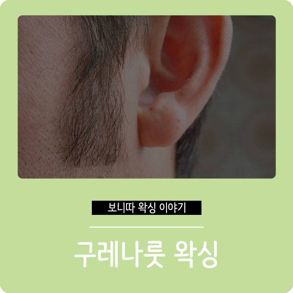구레나룻 왁싱 장점이 무엇일까요 : 네이버 블로그
