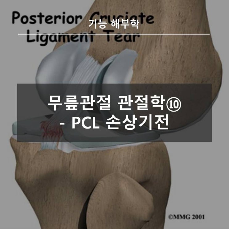 무릎관절의 관절학⑩ - 뒤십자인대의 손상기전(PCL injury mechanism) : 네이버 블로그